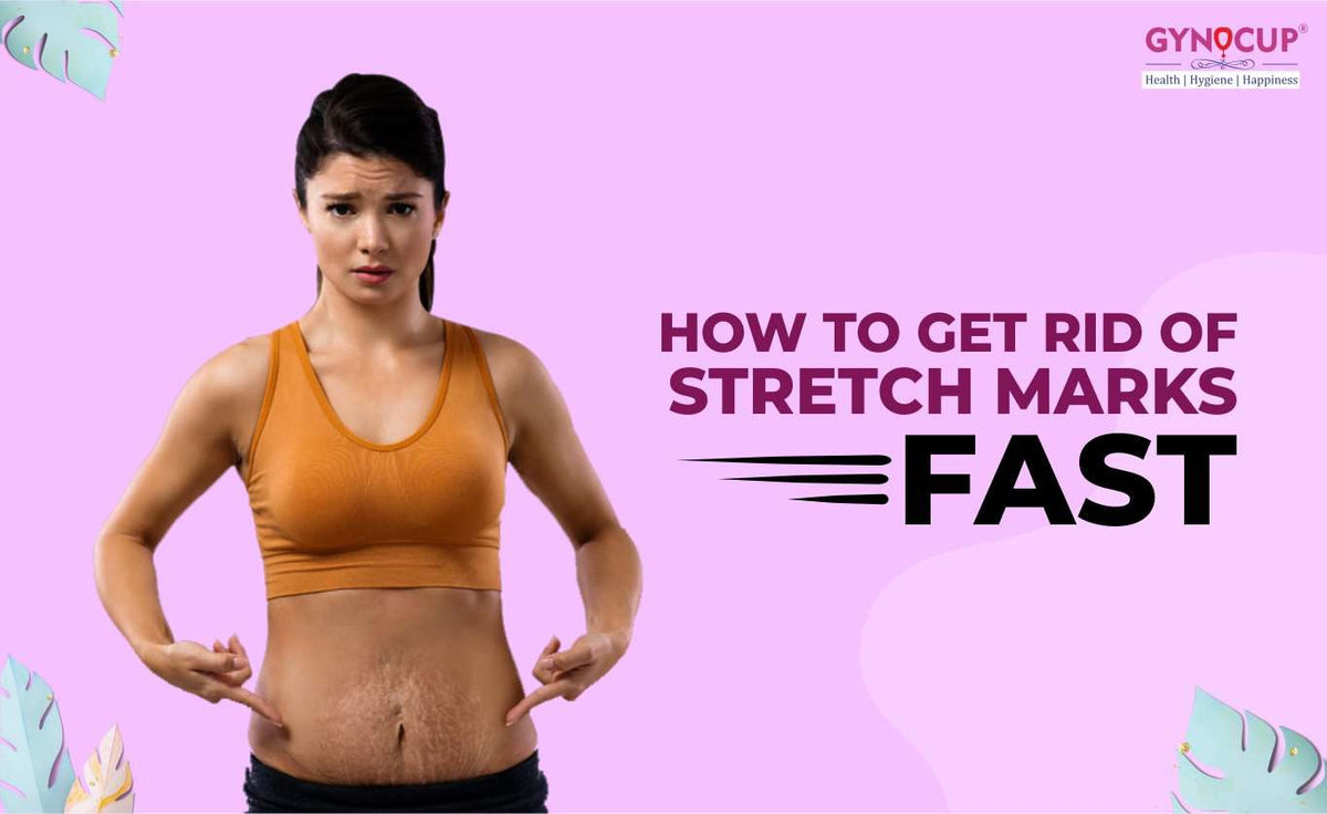 How To Get Rid Of Stretch Marks Faster And Naturally Best Tips Gynocup
